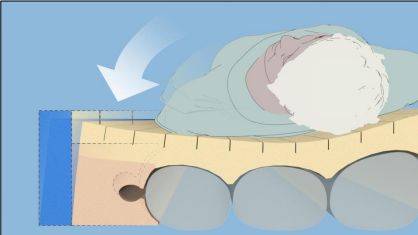 Safety Edge – MEDILOGIX